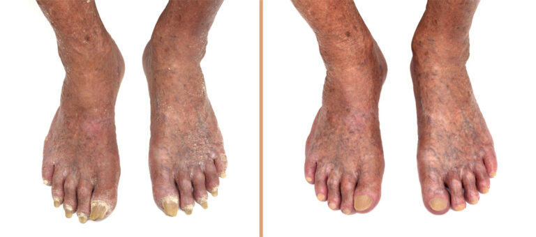 Home - The Toe Lady